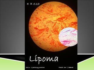 Pathology slides | PPT