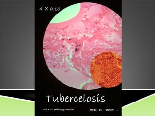 Pathology slides | PPT