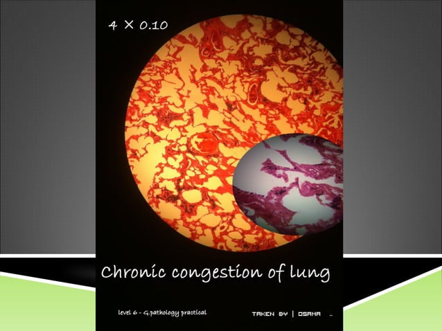 Pathology slides | PPT