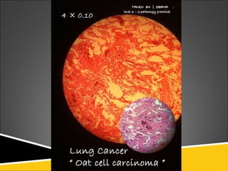 Pathology slides | PPT