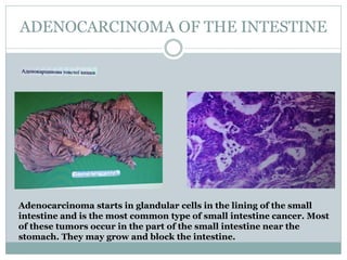 Pathology Slides For Exam (Kiev Medical University) | PDF