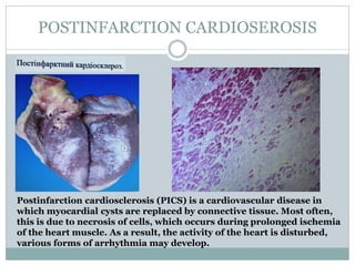 Pathology Slides For Exam (Kiev Medical University) | PDF