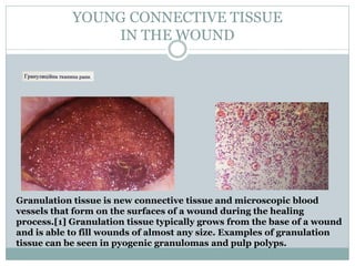 Pathology Slides For Exam (Kiev Medical University) | PDF