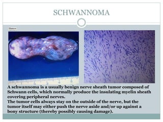 Pathology Slides For Exam (Kiev Medical University) | PDF