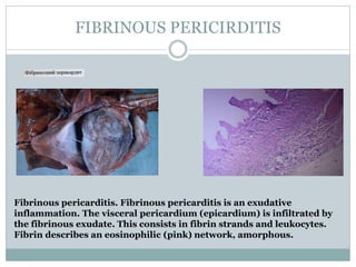 Pathology Slides For Exam (Kiev Medical University) | PDF