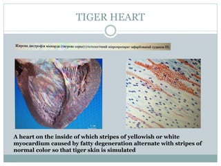 Pathology Slides For Exam (Kiev Medical University) | PPT