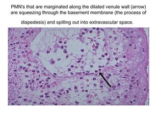 Basic Pathology lab slides | PDF