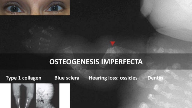 Bone Pathology snaps | PPTX | Bone and Joint Conditions | Diseases and ...