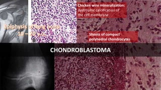 Bone Pathology snaps | PPTX