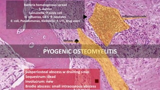 Bone Pathology snaps | PPTX