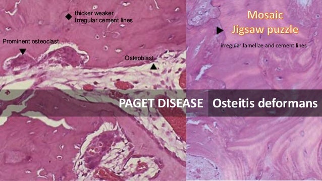 Bone Pathology snaps