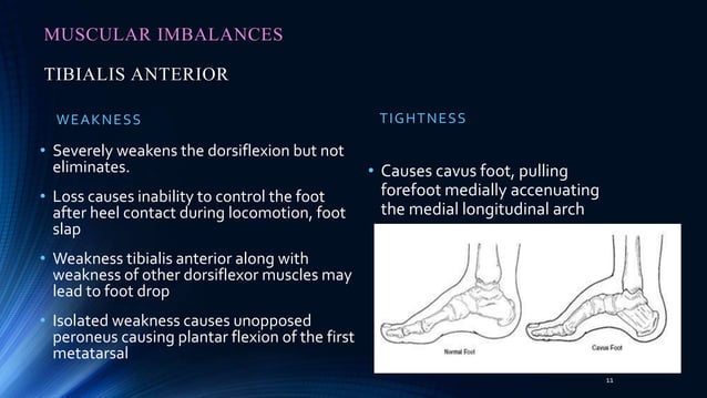 Pathomechanics of Ankle joint | PPTX