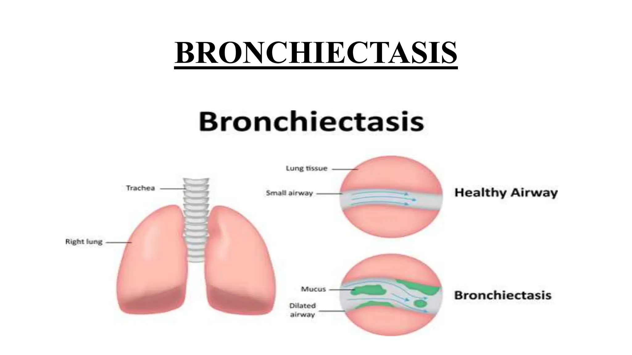 pathomechanics of thorax explanation.pptx