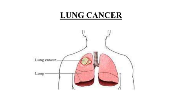 pathomechanics of thorax explanation.pptx | Lung and Respiratory Health ...