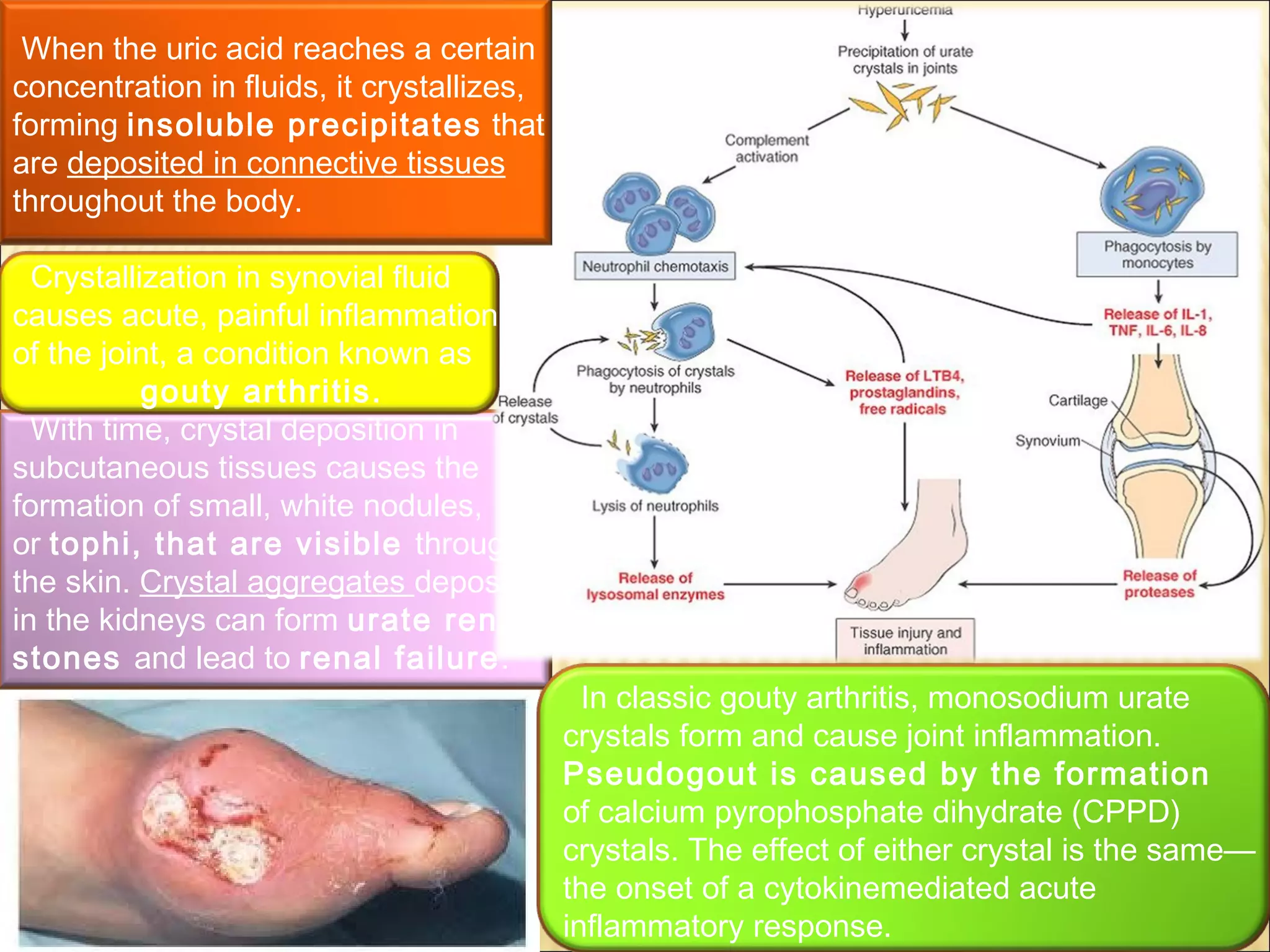 Pathophysiology of carbohydrates and proteins metabolism | PPT