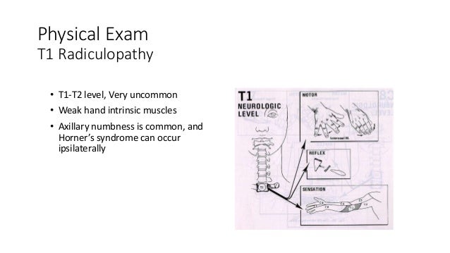 Pathophysiologic aspects, clinical manifestation a nd management of
