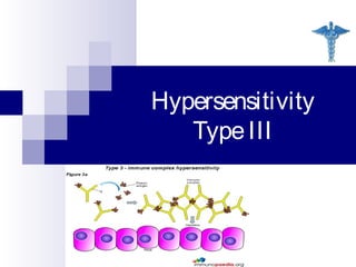 Hypersensitity, And Types of Hypersensitivity I, II, III, IV | PPT