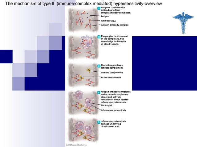 Hypersensitity, And Types of Hypersensitivity I, II, III, IV | PPT