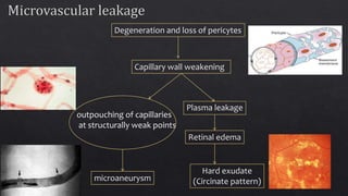Pathophysiology of Diabetic retinopathy | PPTX