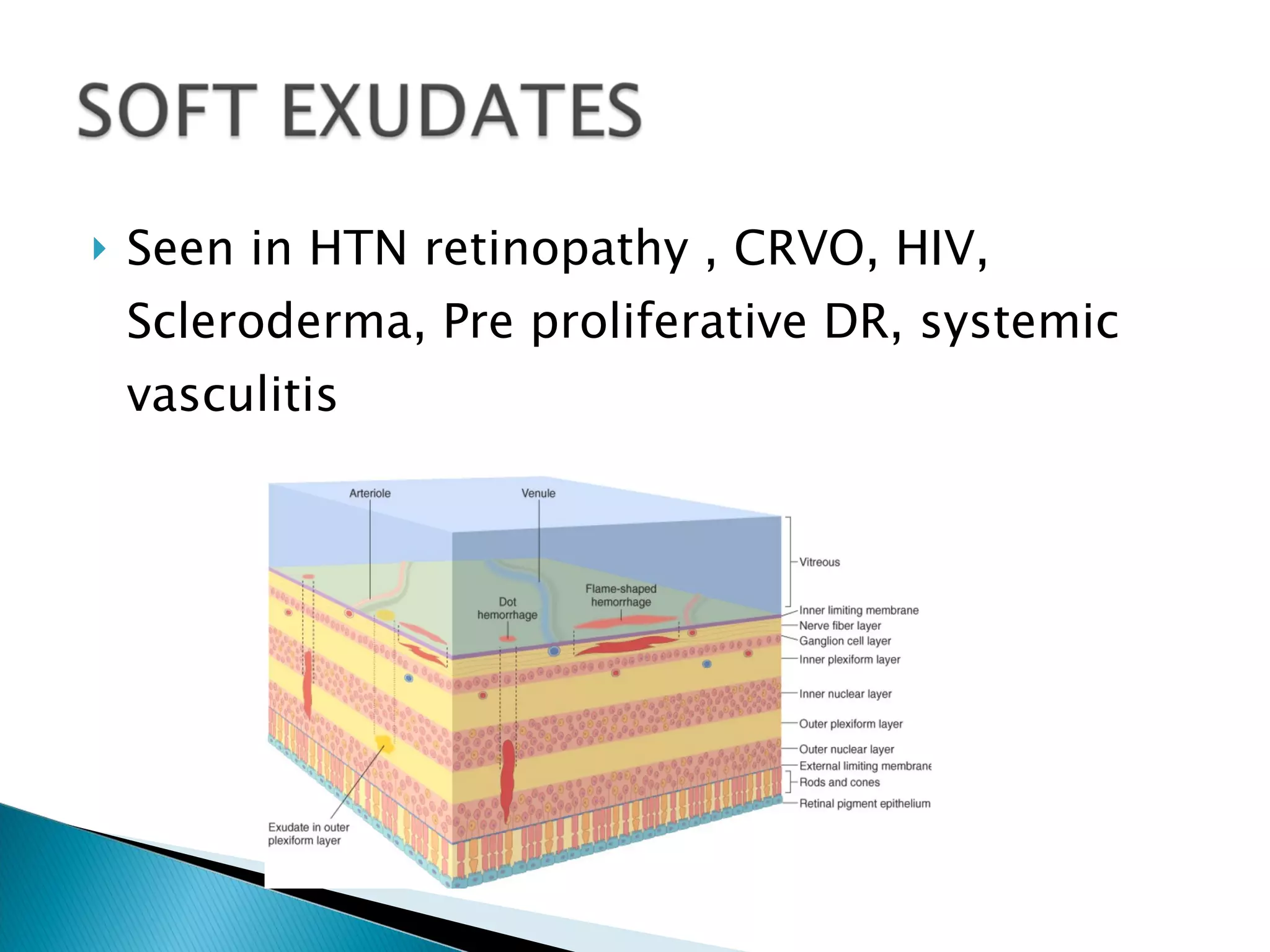 Retinal lesions Pathophysiology | PPT