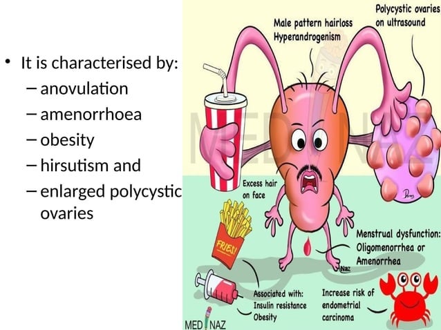 PATHOPHYSIOLOGY AND DIAGNOSIS OF PCOS.pptx