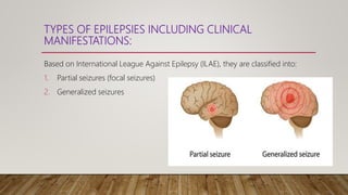 Pathophysiology and management of epilepsy | PPTX