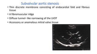 Pathophysiology aortic valve disease | PPTX