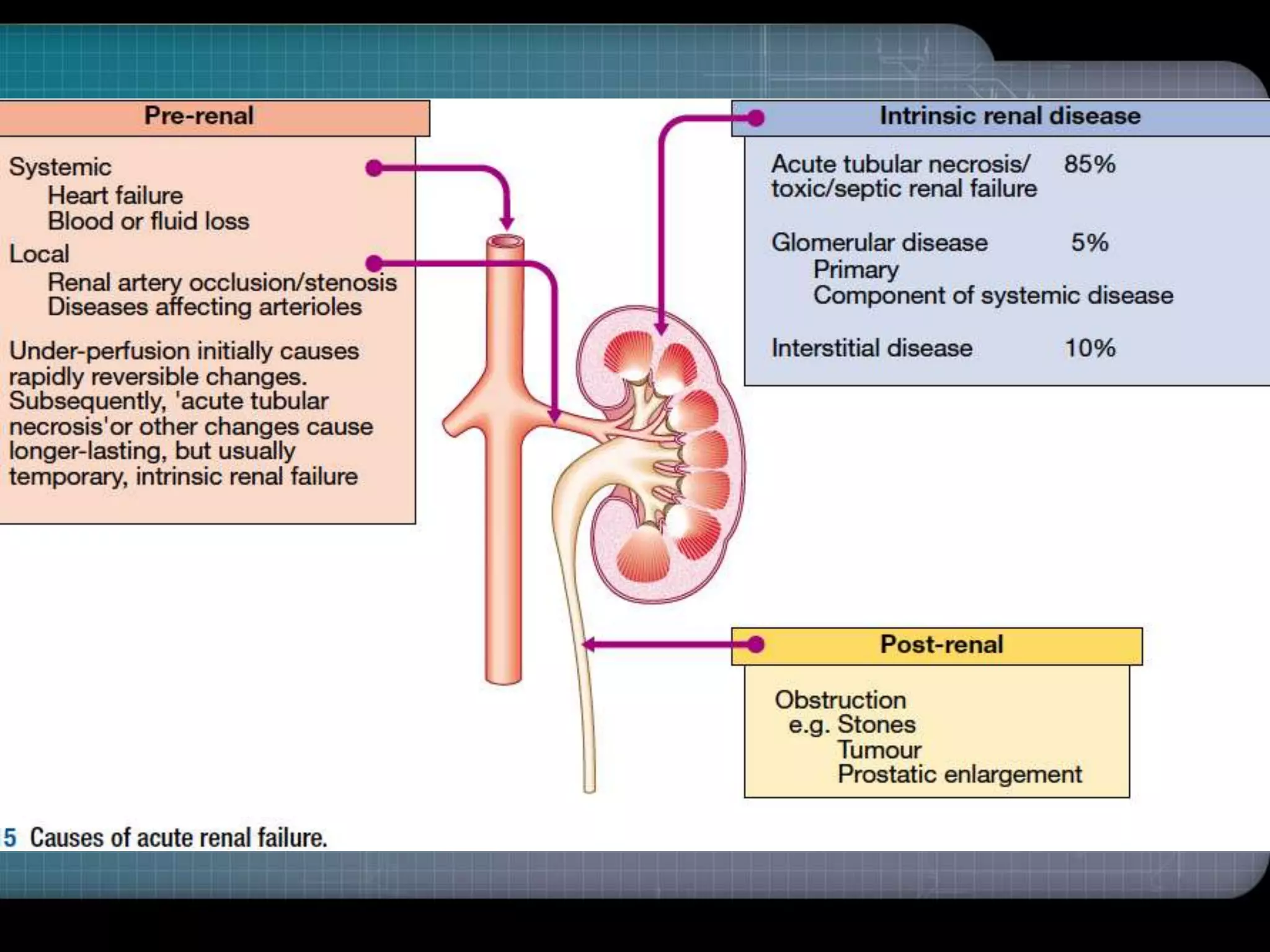 Pathophysiology arf. | PPTX