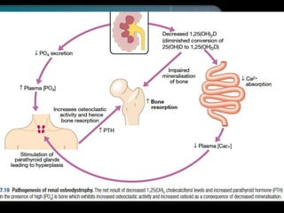 Pathophysiology arf. | PPT