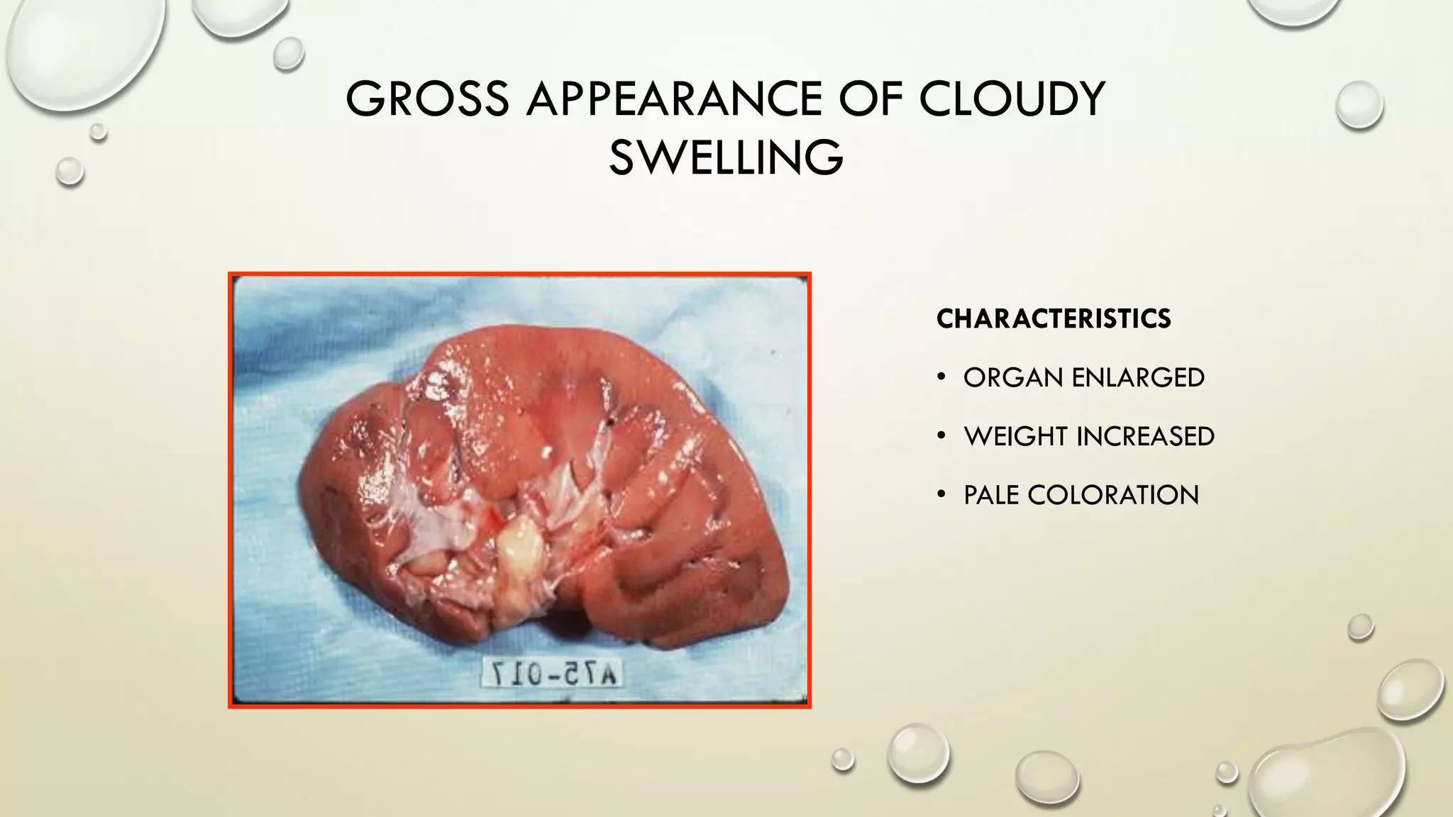 Pathophysiology cell injury | PDF