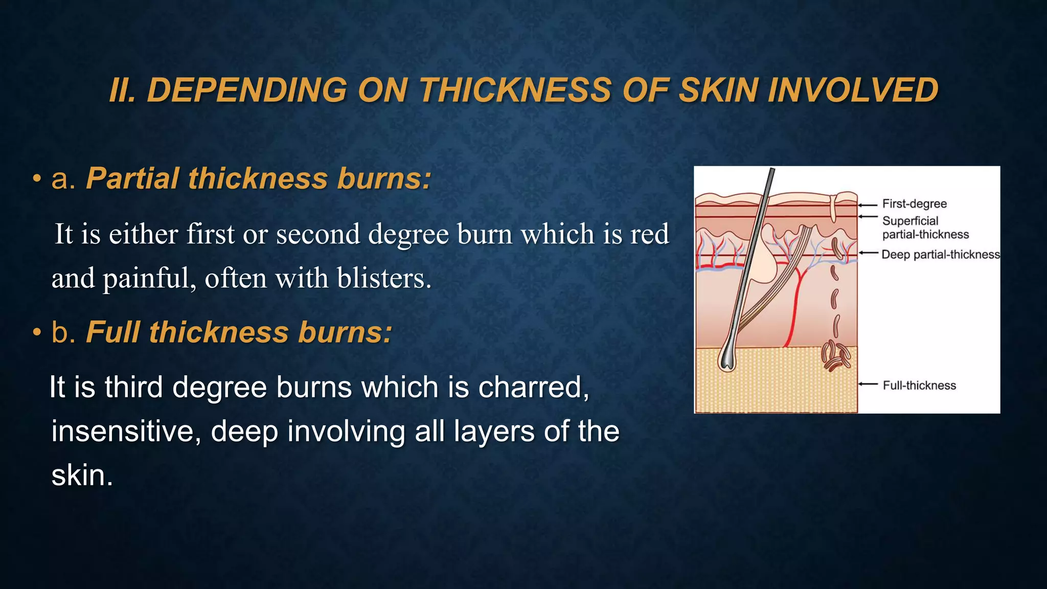 Pathophysiology and complications of burn | PPTX