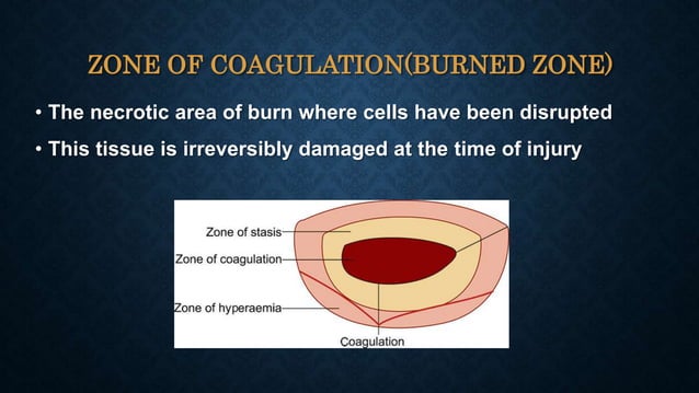 Pathophysiology and complications of burn | PPTX | First Aid | Injuries