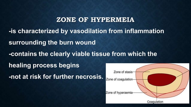 Pathophysiology and complications of burn | PPTX | First Aid | Injuries