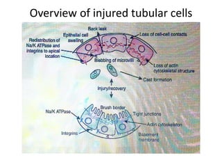 Pathophysiology of acute kidney injury | PPTX