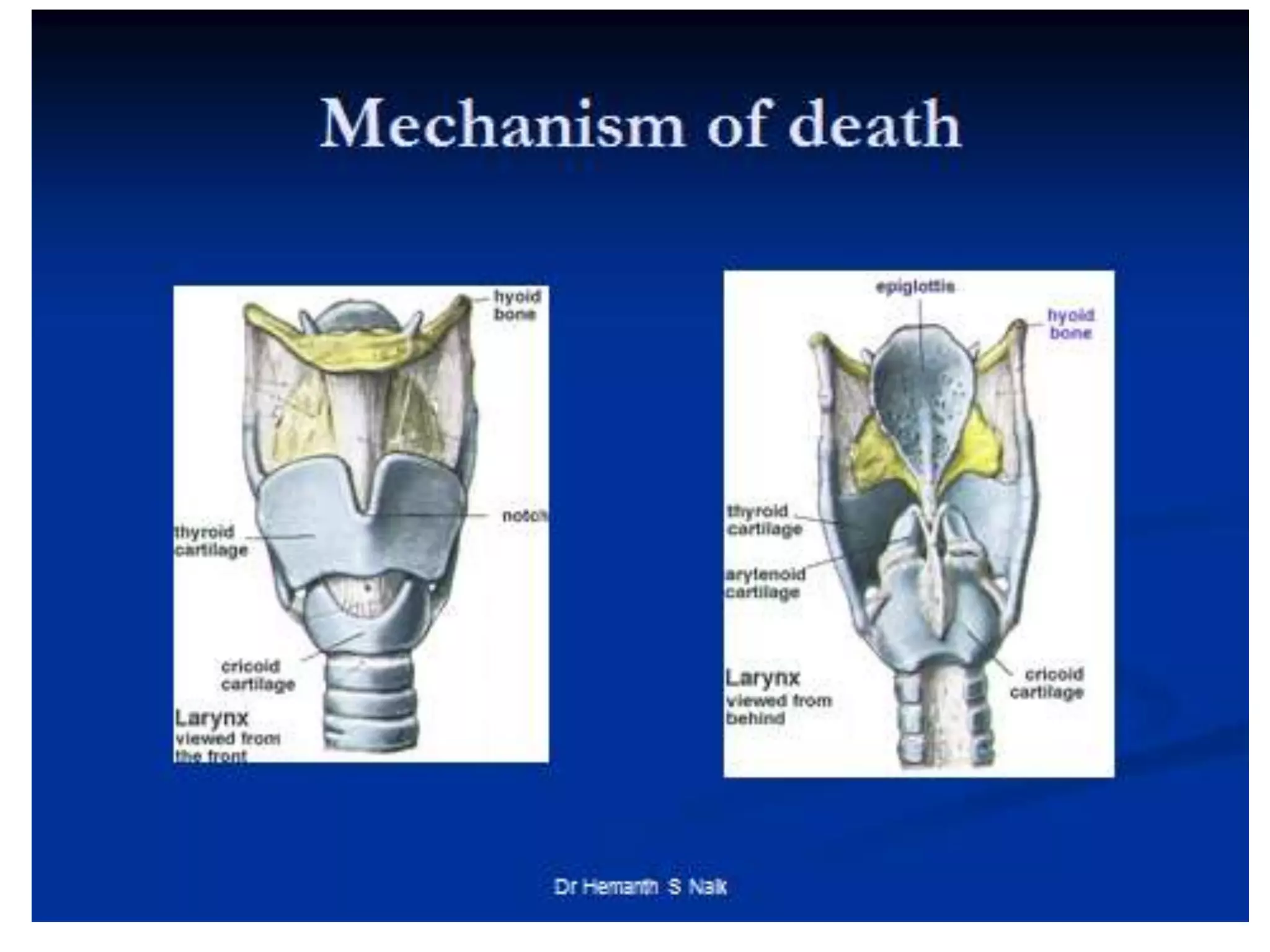 Pathophysiology of asphyxia & drowning | PPTX
