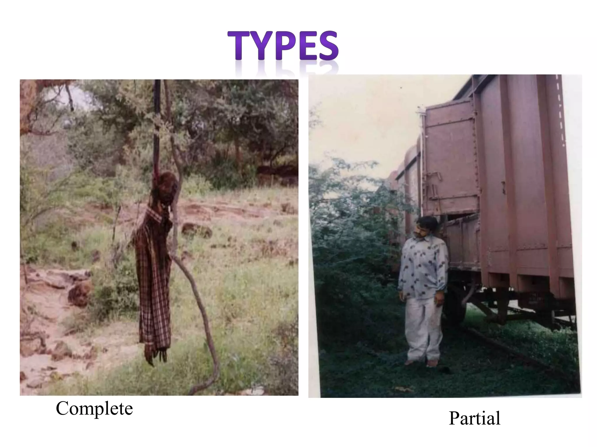 Pathophysiology of asphyxia & drowning | PPTX