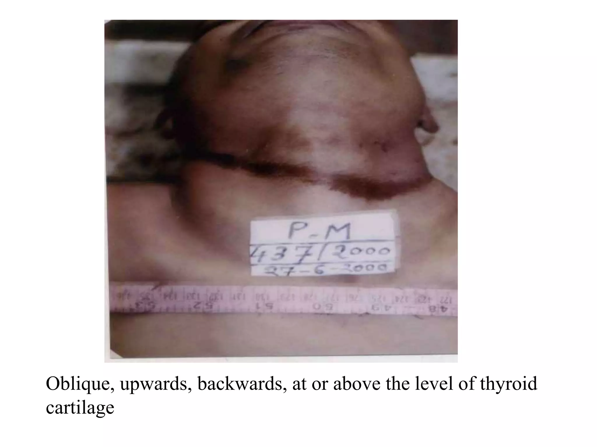 Pathophysiology of asphyxia & drowning | PPTX