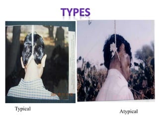 Pathophysiology of asphyxia & drowning | PPTX