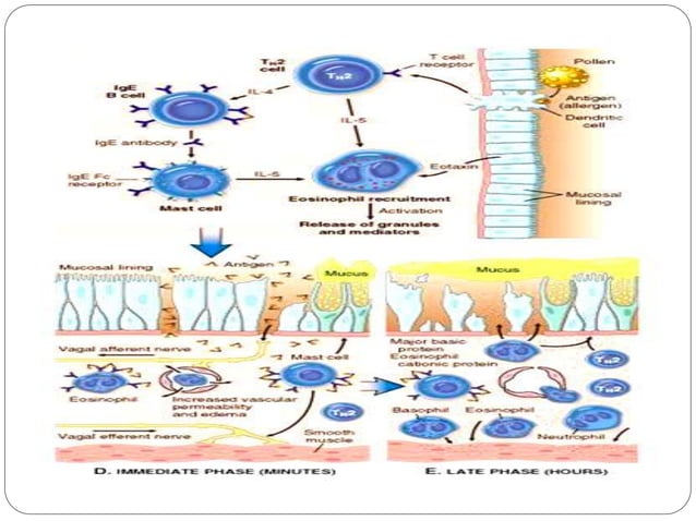 Pathophysiology of asthma | PPTX