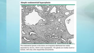 PATHOPHYSIOLOGY OF AUB.pptx
