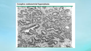 PATHOPHYSIOLOGY OF AUB.pptx