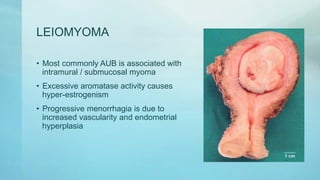 PATHOPHYSIOLOGY OF AUB.pptx