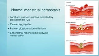 PATHOPHYSIOLOGY OF AUB.pptx