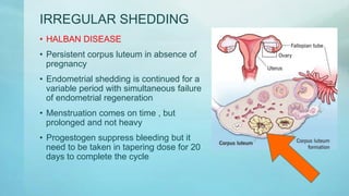 PATHOPHYSIOLOGY OF AUB.pptx