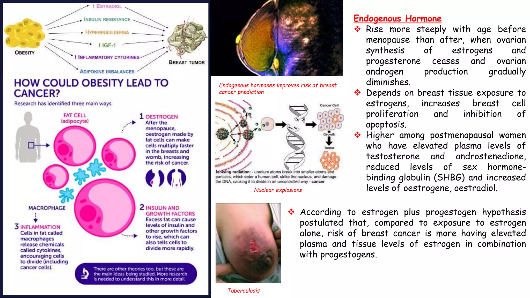 Pathophysiology of breast cancer | PPTX