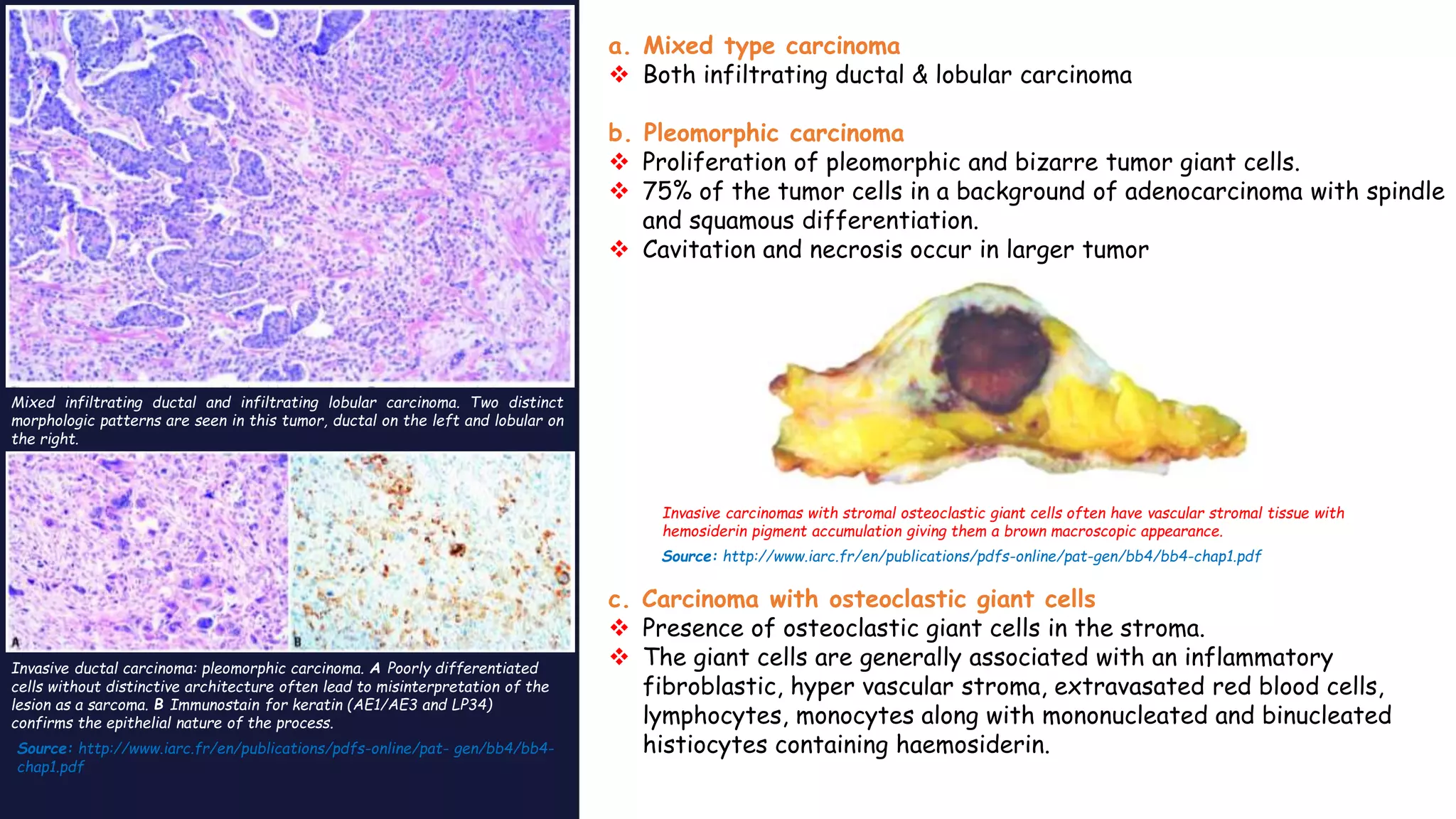 Pathophysiology of breast cancer | PPTX