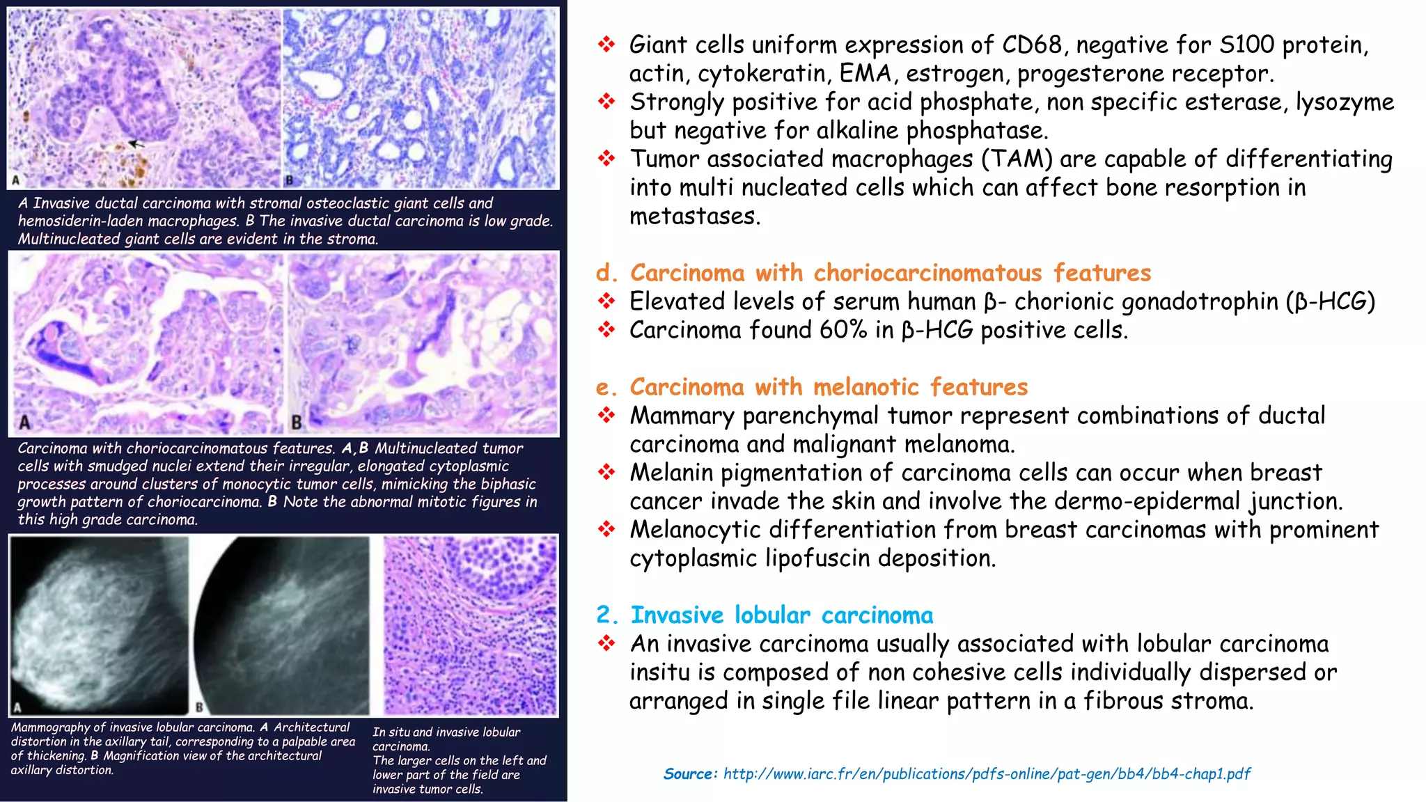 Pathophysiology of breast cancer | PPTX