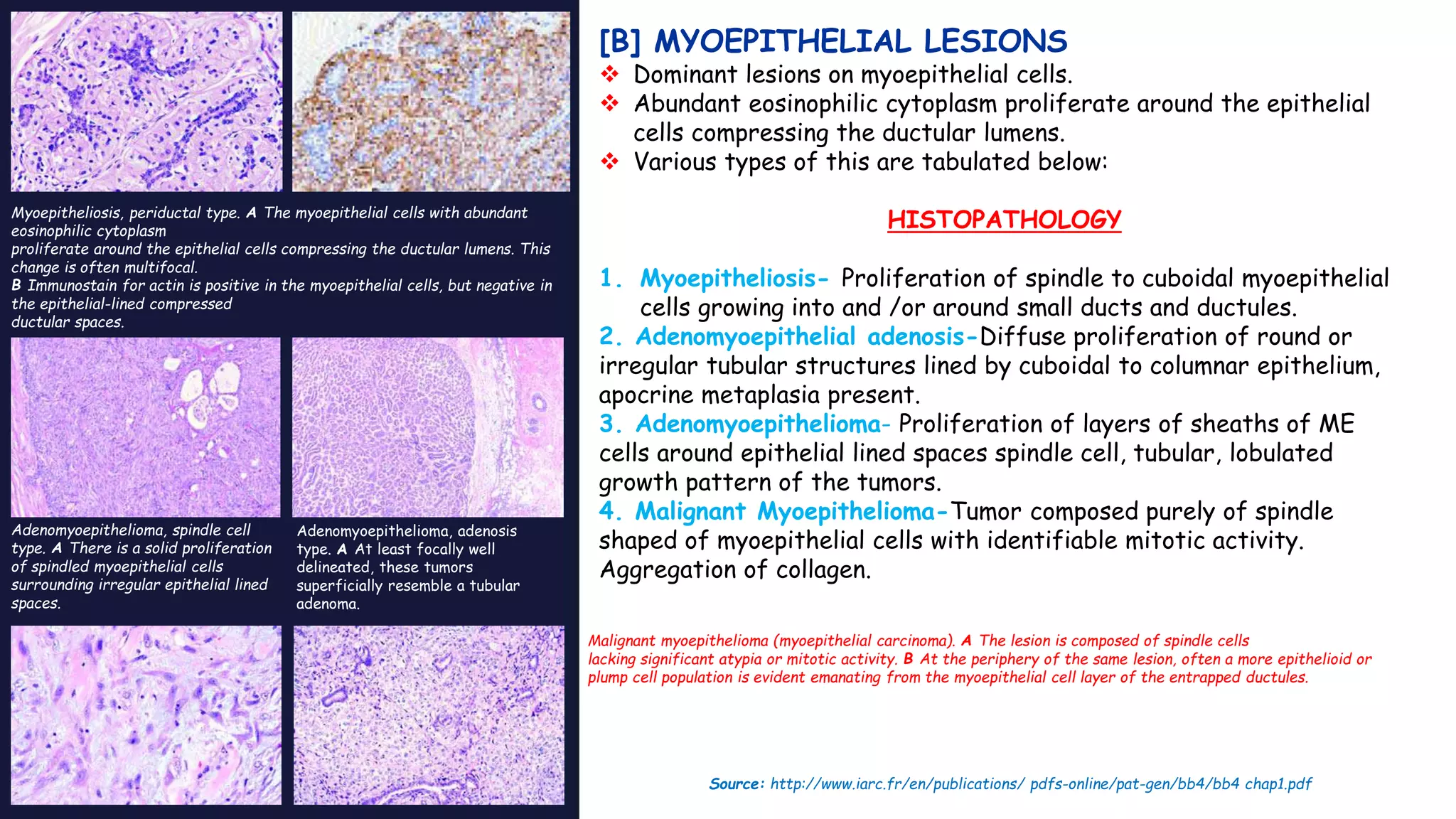 Pathophysiology of breast cancer | PPTX