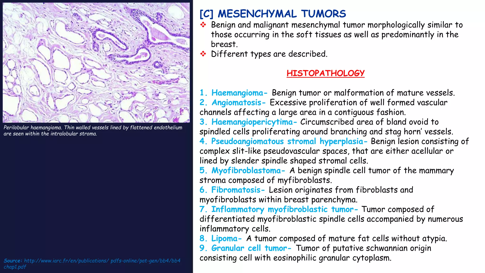 Pathophysiology of breast cancer | PPTX