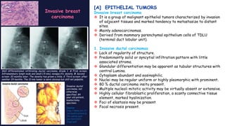 Pathophysiology of breast cancer | PPTX